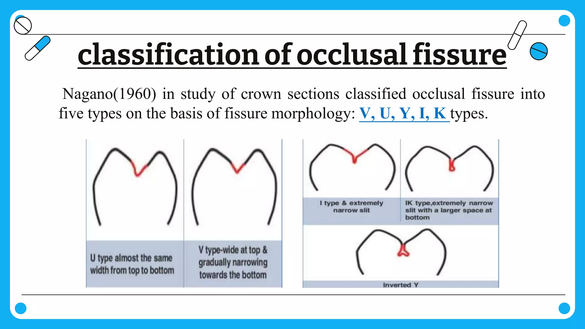 Pit and Fissure Sealants | PPTX
