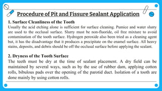 Pit and Fissure Sealants | PPTX
