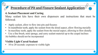 Pit and Fissure Sealants | PPTX