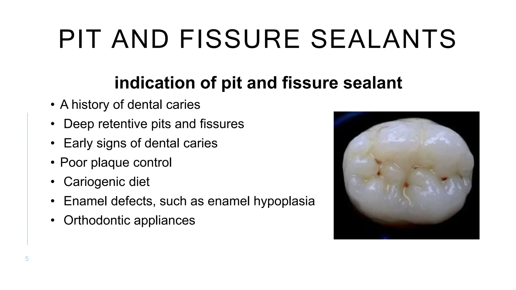 pit and fissure sealants FOR DENTAL .pptx