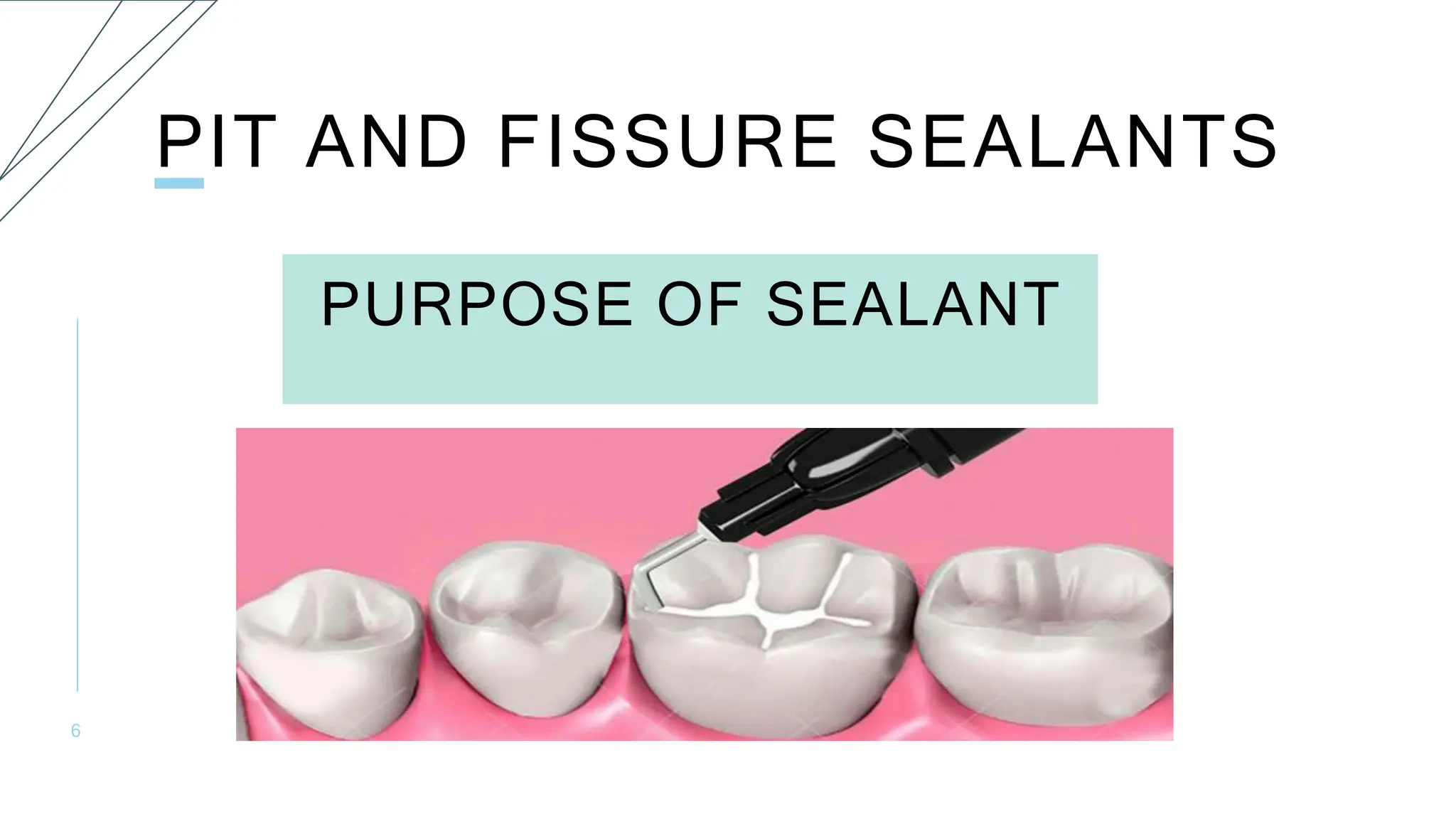 pit and fissure sealants FOR DENTAL .pptx