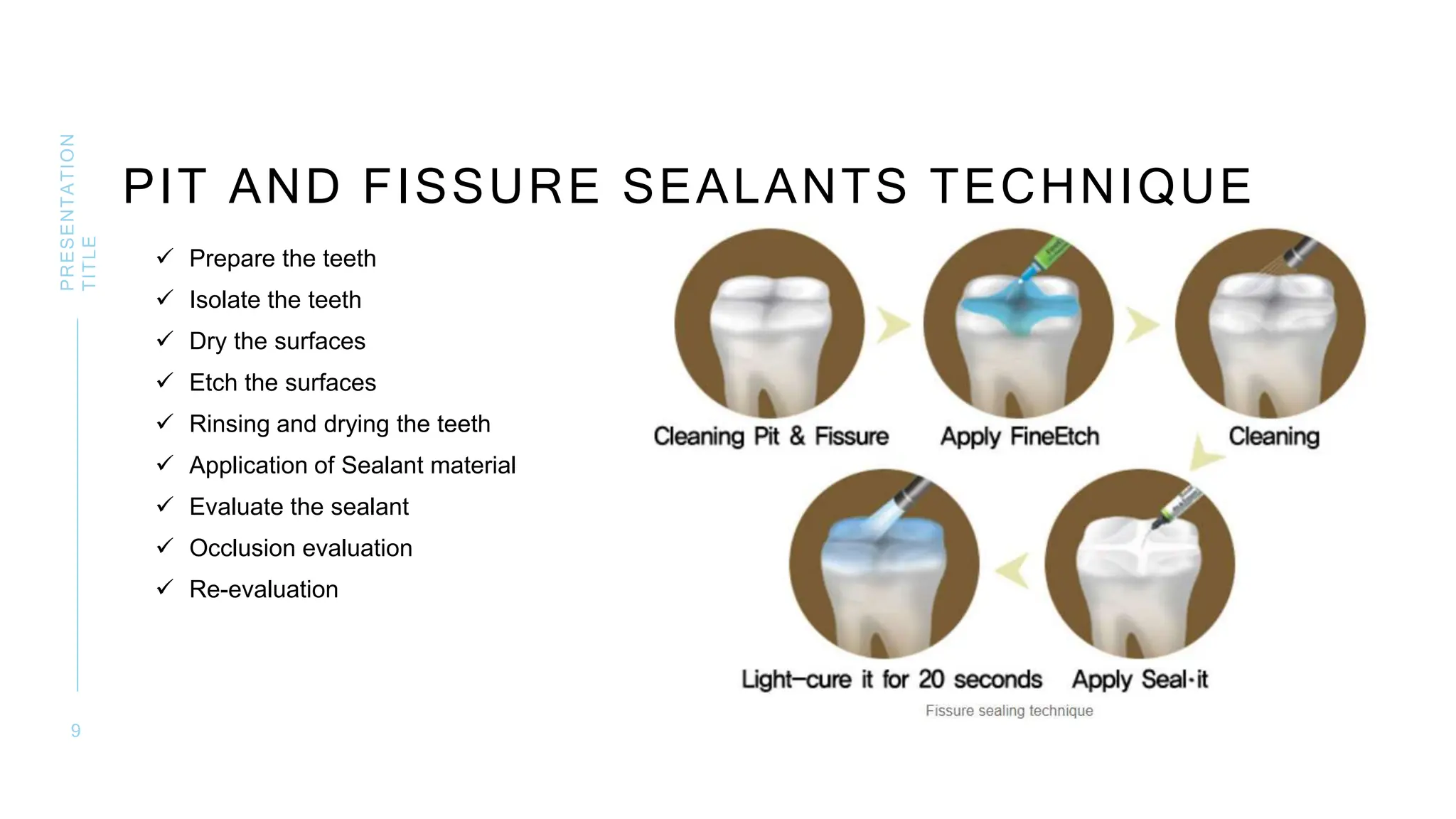 pit and fissure sealants FOR DENTAL .pptx