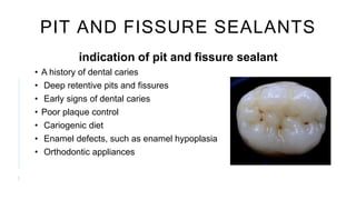 pit and fissure sealants FOR DENTAL .pptx