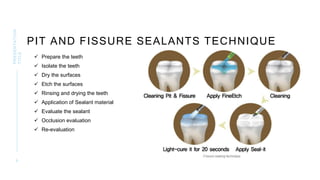 pit and fissure sealants FOR DENTAL .pptx