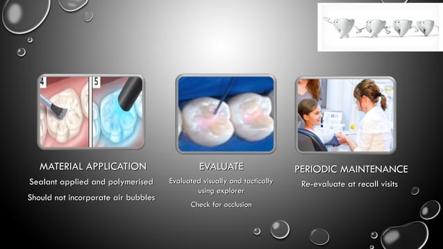 PIT AND FISSURE SEALANTS AND PREVENTIVE RESIN RESTORATIONS | PPT