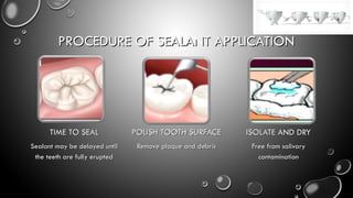 PIT AND FISSURE SEALANTS AND PREVENTIVE RESIN RESTORATIONS | PPT