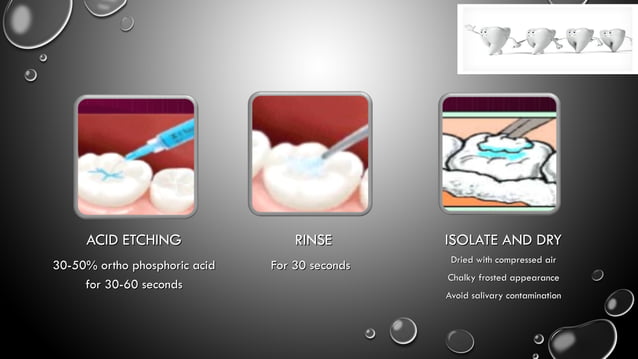 PIT AND FISSURE SEALANTS AND PREVENTIVE RESIN RESTORATIONS | PPT