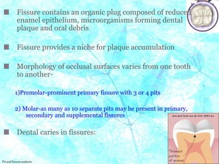 PIT AND FISSURE SEALANTS 1.ppt