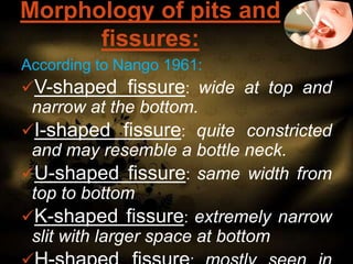 Pit And Fissure Sealants-Subhajit Saha | PPTX