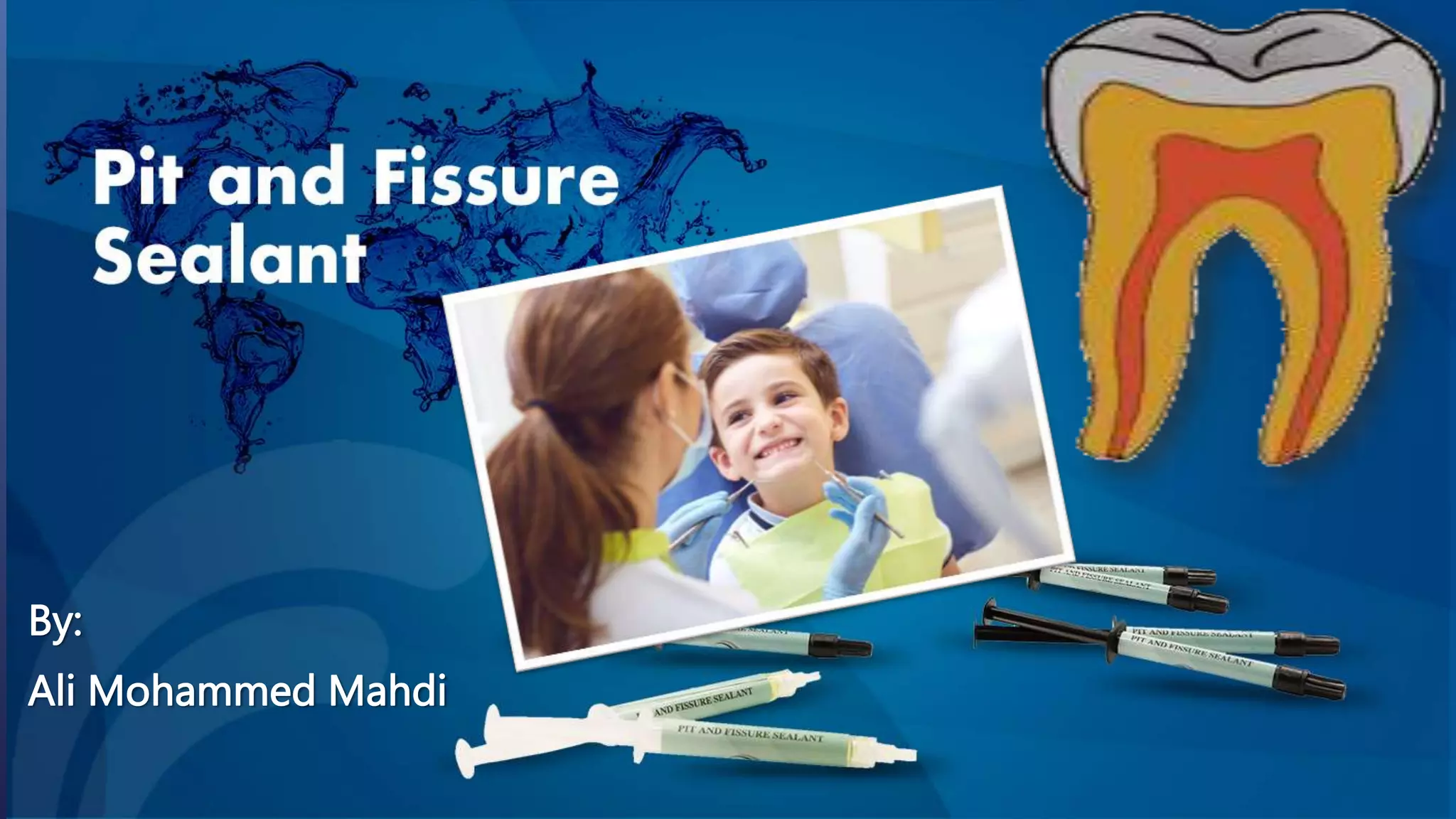 Pit and Fissure Sealants Dr. Ali Mohammed | PPT