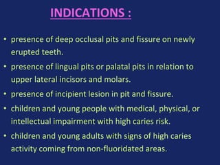 Pit and fissure sealants | PPTX