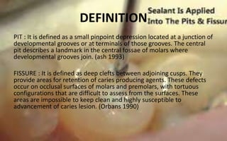 Pit and fissure vivek jc 6 | PPTX