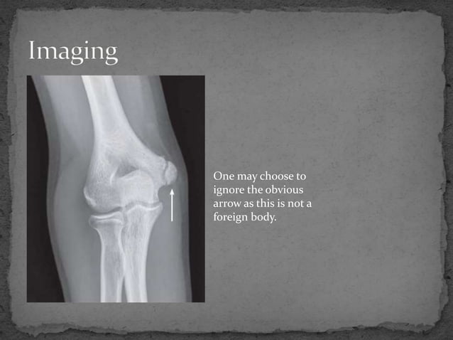 Pitcher's Elbow Power Point | PPT