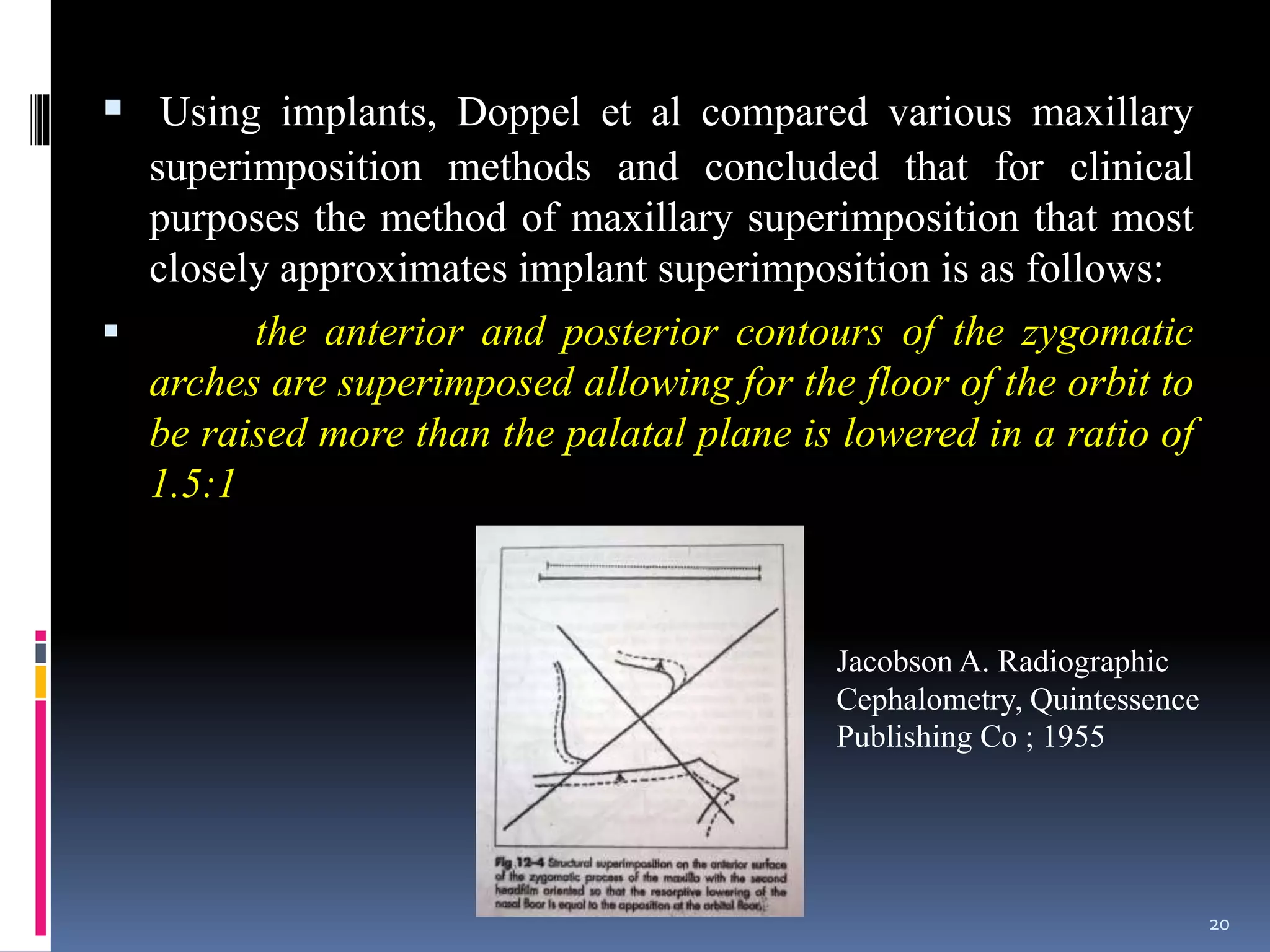 Pitchfork Analysis | PPTX
