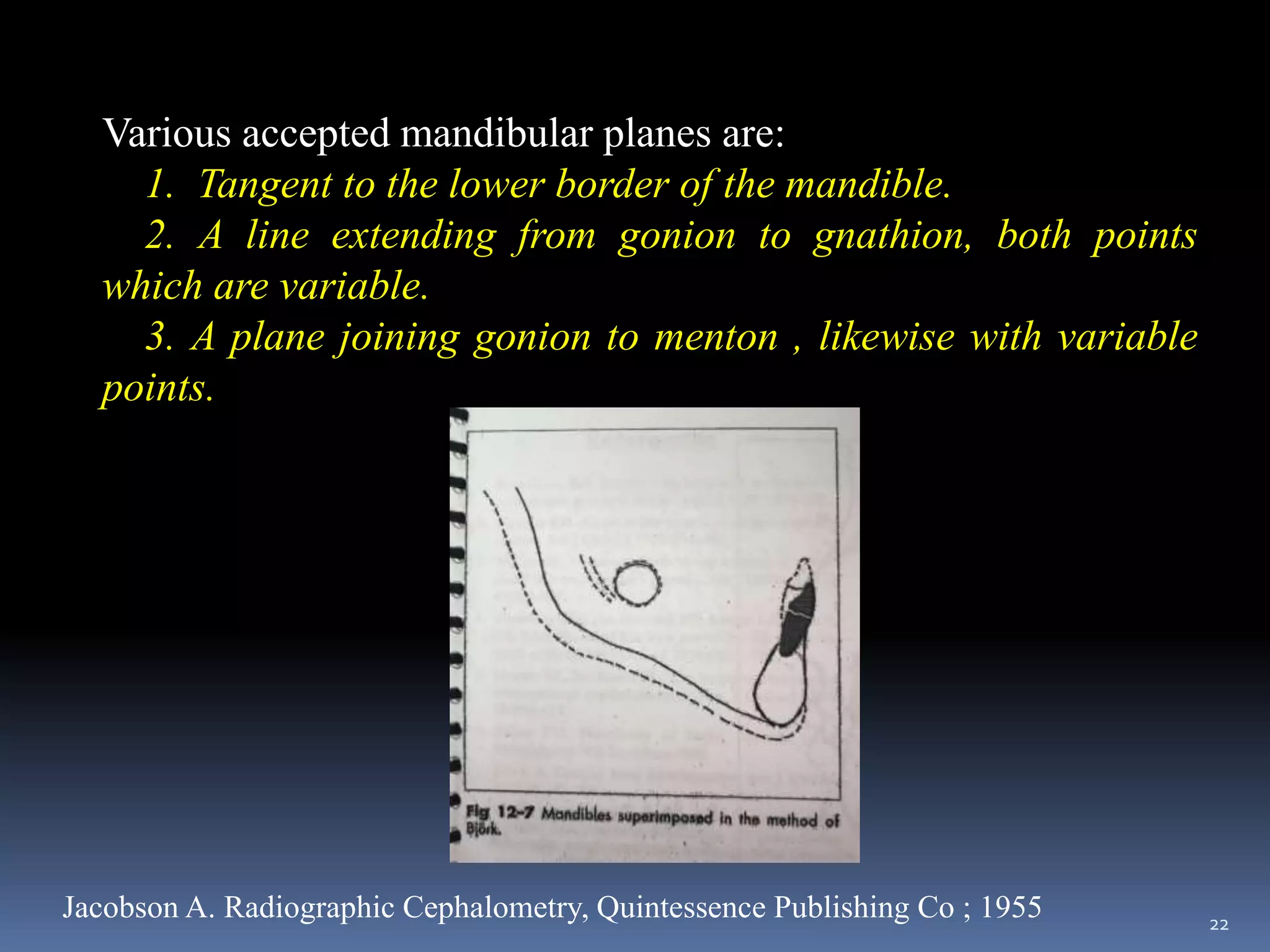 Pitchfork Analysis | PPTX