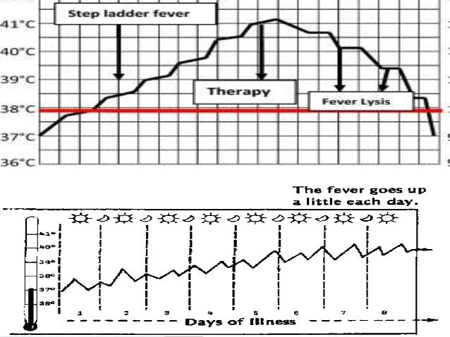 Pit fall in typhoid fever 2016