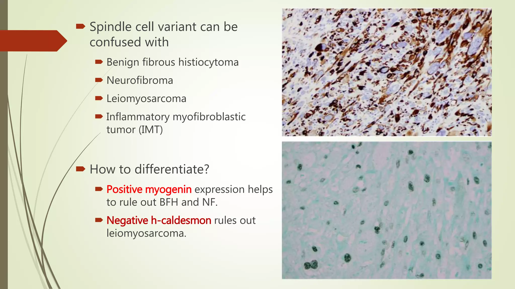 Pitfalls in diagnosis of soft tissue tumors of childhood | PPTX