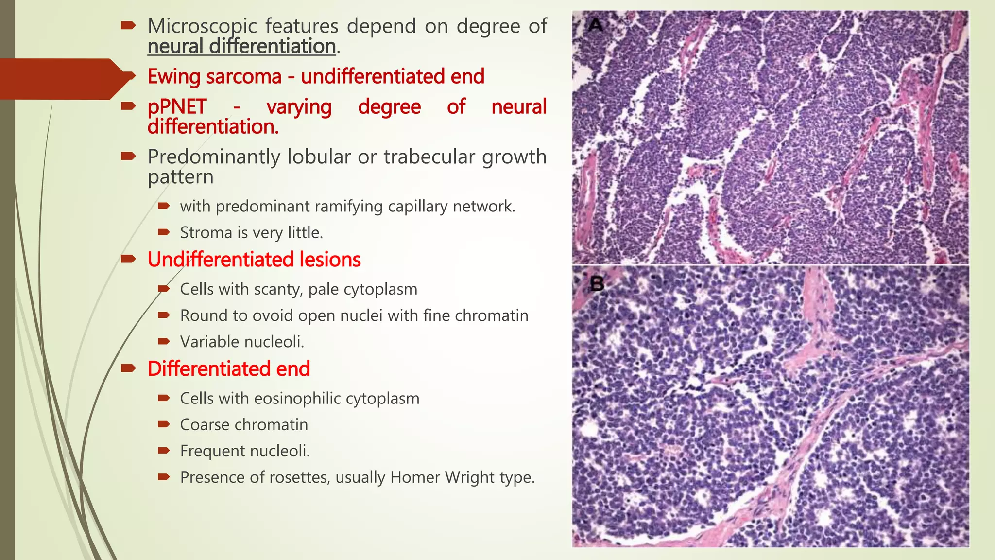 Pitfalls in diagnosis of soft tissue tumors of childhood | PPTX