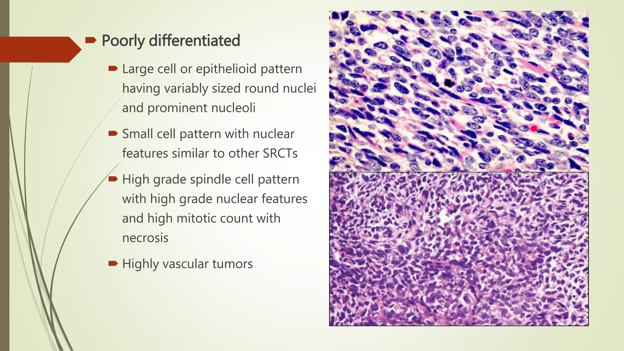 Pitfalls in diagnosis of soft tissue tumors of childhood | PPTX