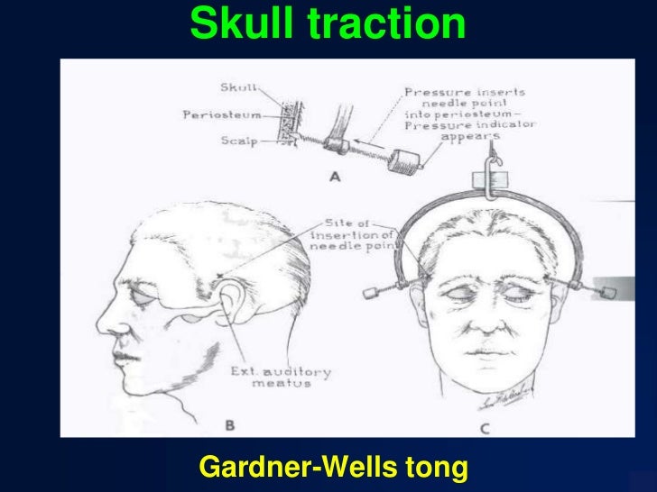Pitfalls in orthopaedics