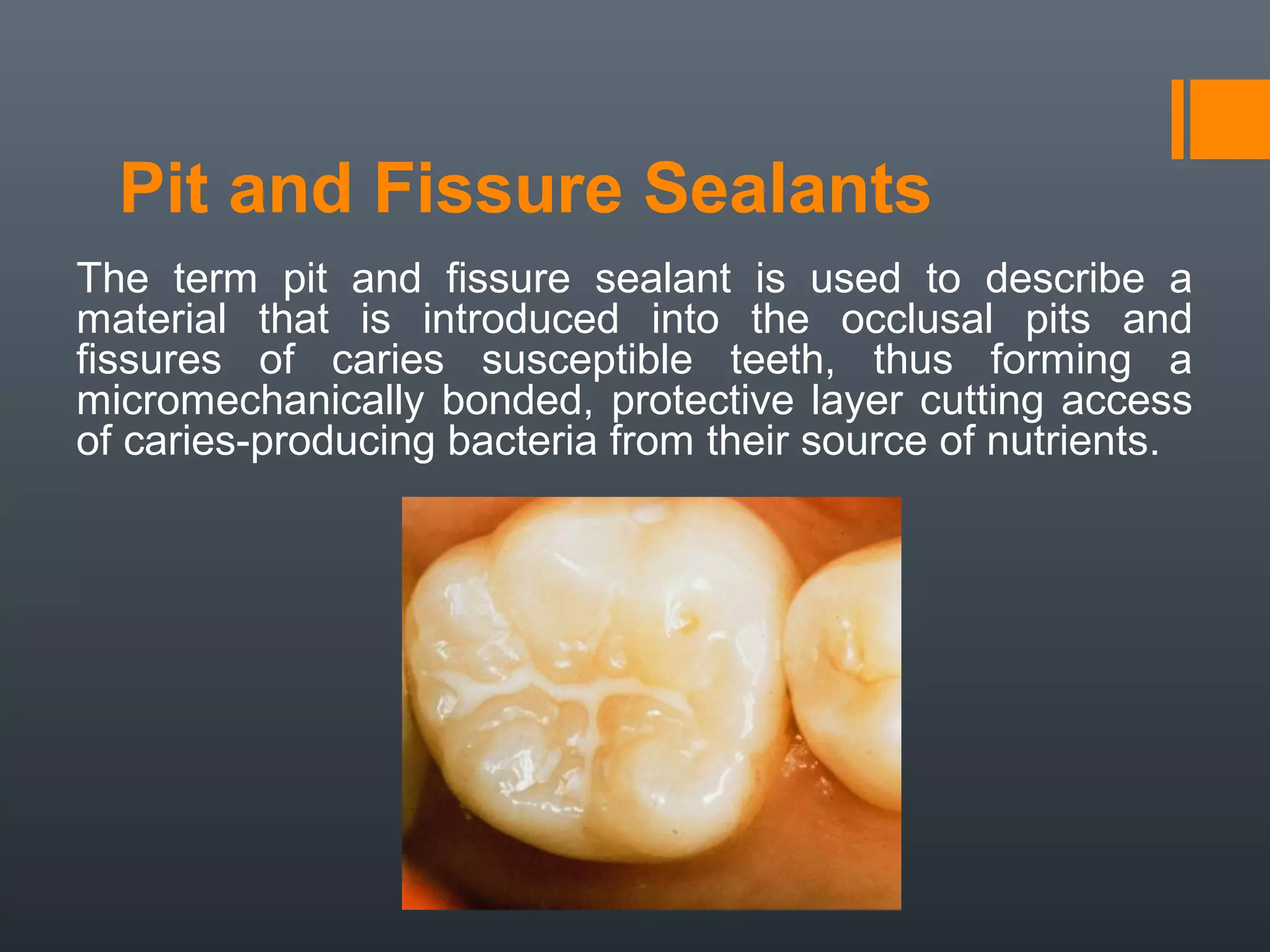 Pit and Fissure Sealant | PPT