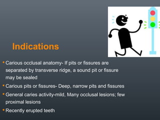 Pit and Fissure Sealant | PPT