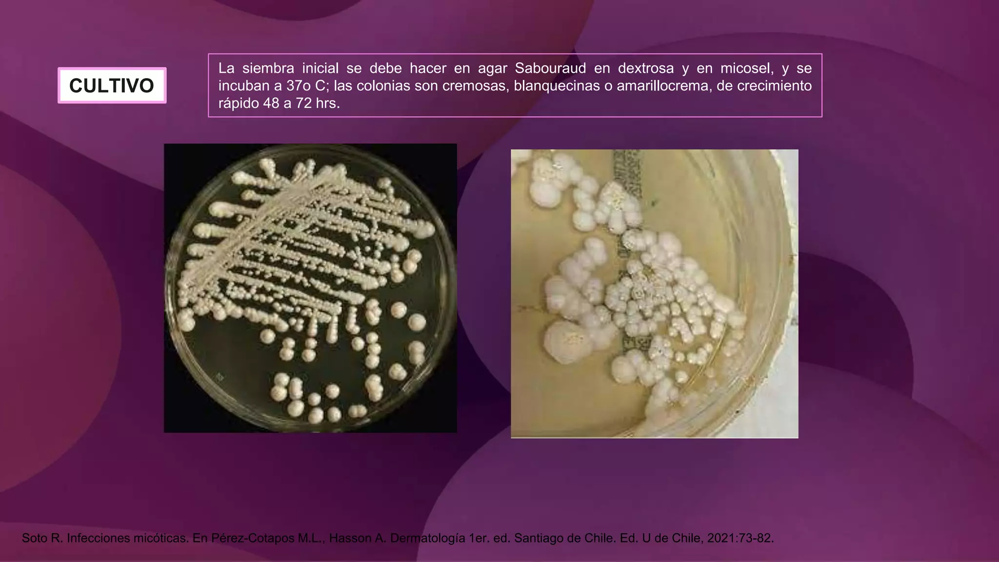 PITIRIASIS VERSICOLOR Y CANDIDIASIS.pptx
