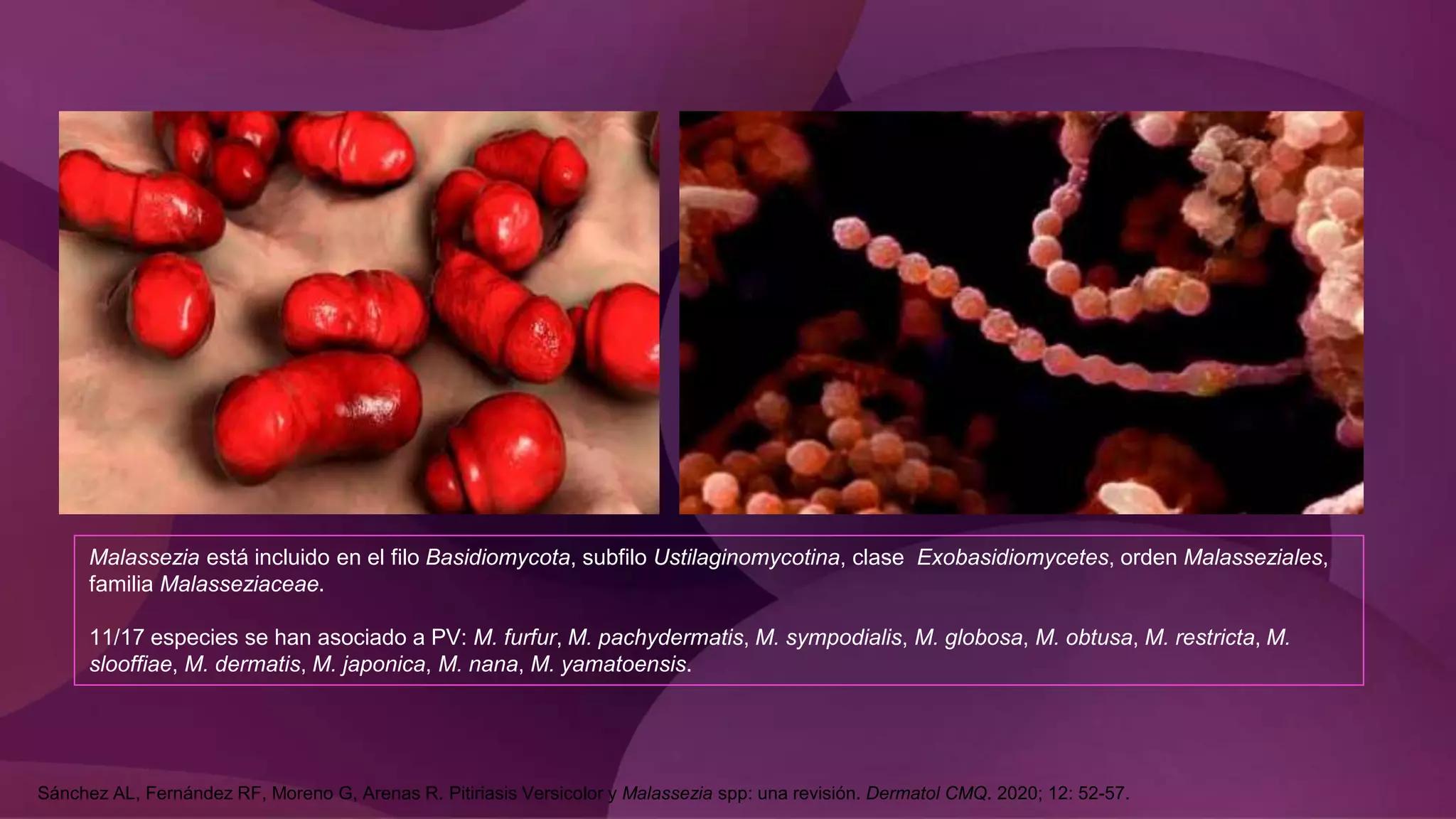 PITIRIASIS VERSICOLOR Y CANDIDIASIS.pptx