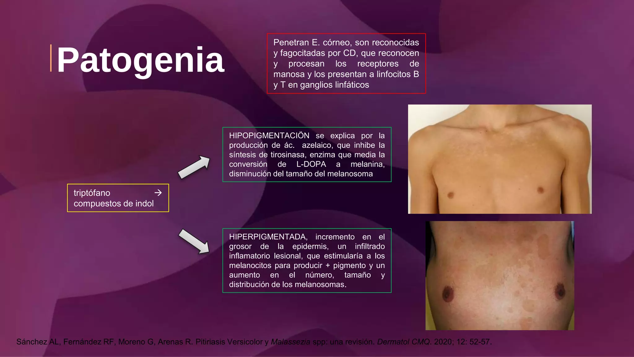 PITIRIASIS VERSICOLOR Y CANDIDIASIS.pptx