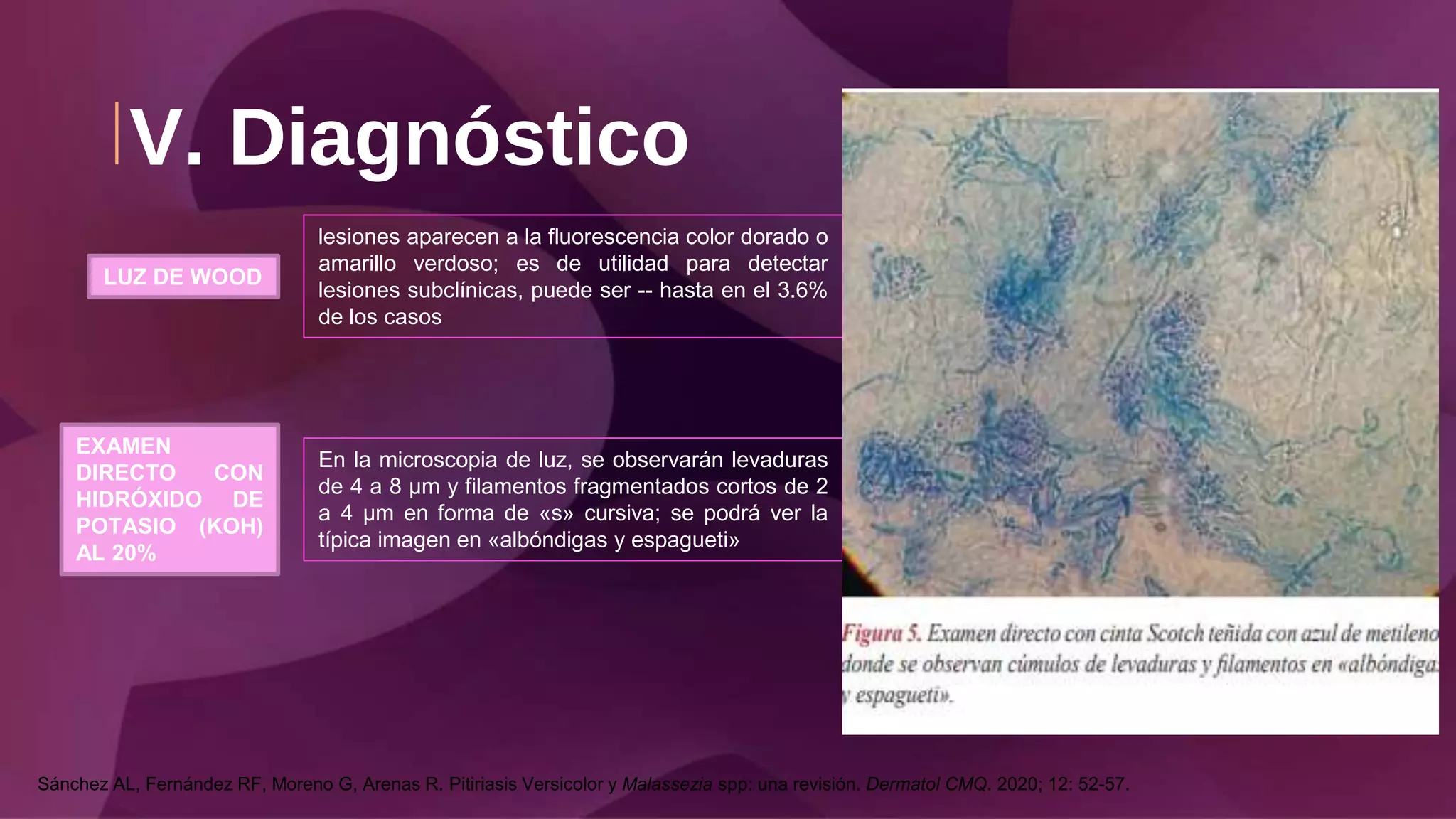 PITIRIASIS VERSICOLOR Y CANDIDIASIS.pptx