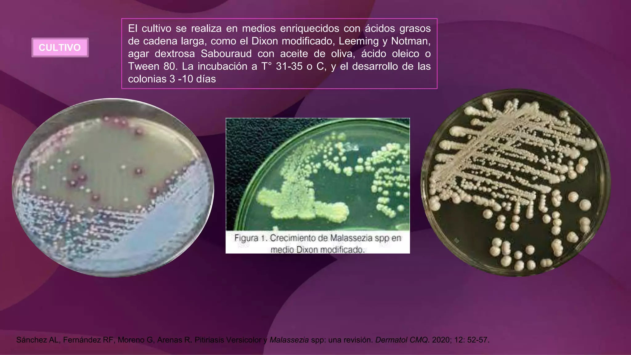 PITIRIASIS VERSICOLOR Y CANDIDIASIS.pptx | Descarga Gratuita