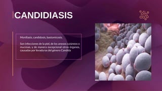 PITIRIASIS VERSICOLOR Y CANDIDIASIS.pptx