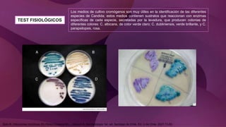 PITIRIASIS VERSICOLOR Y CANDIDIASIS.pptx