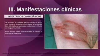 PITIRIASIS VERSICOLOR Y CANDIDIASIS.pptx