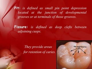 pit and fissure sealants used in dentistry | PPT