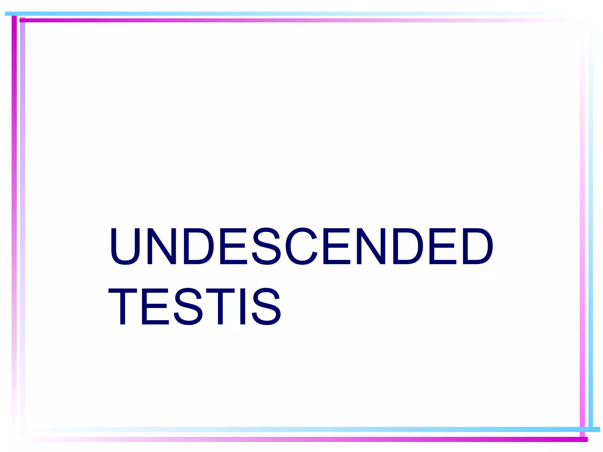 undescended testis | PPT
