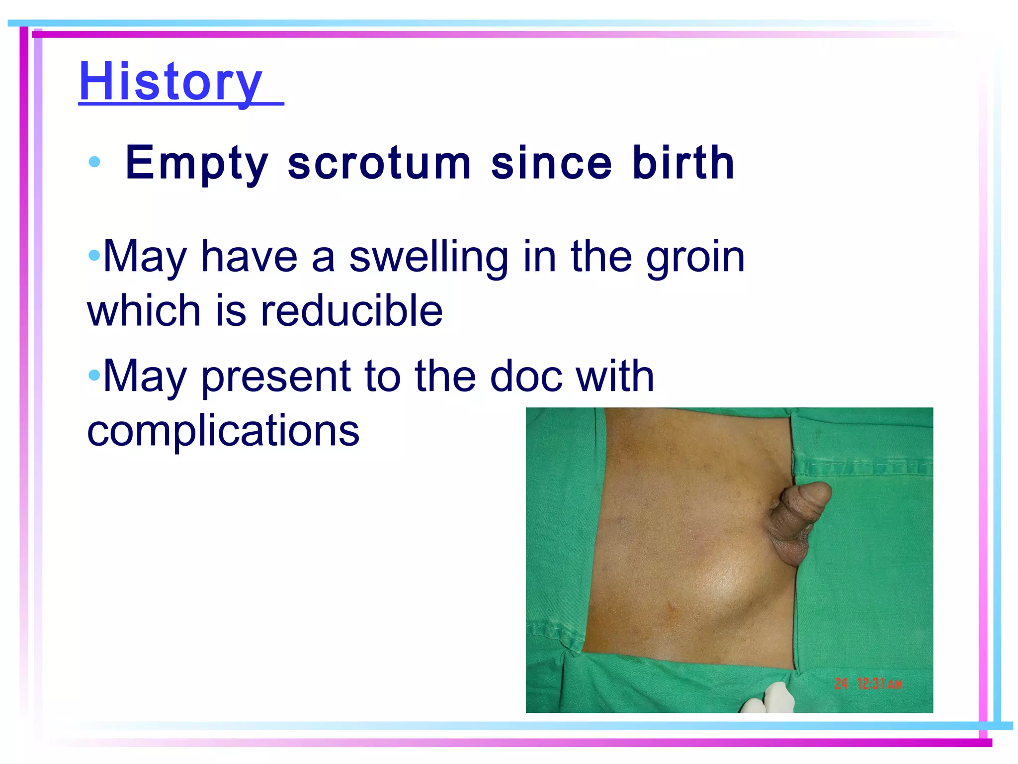 undescended testis | PPT