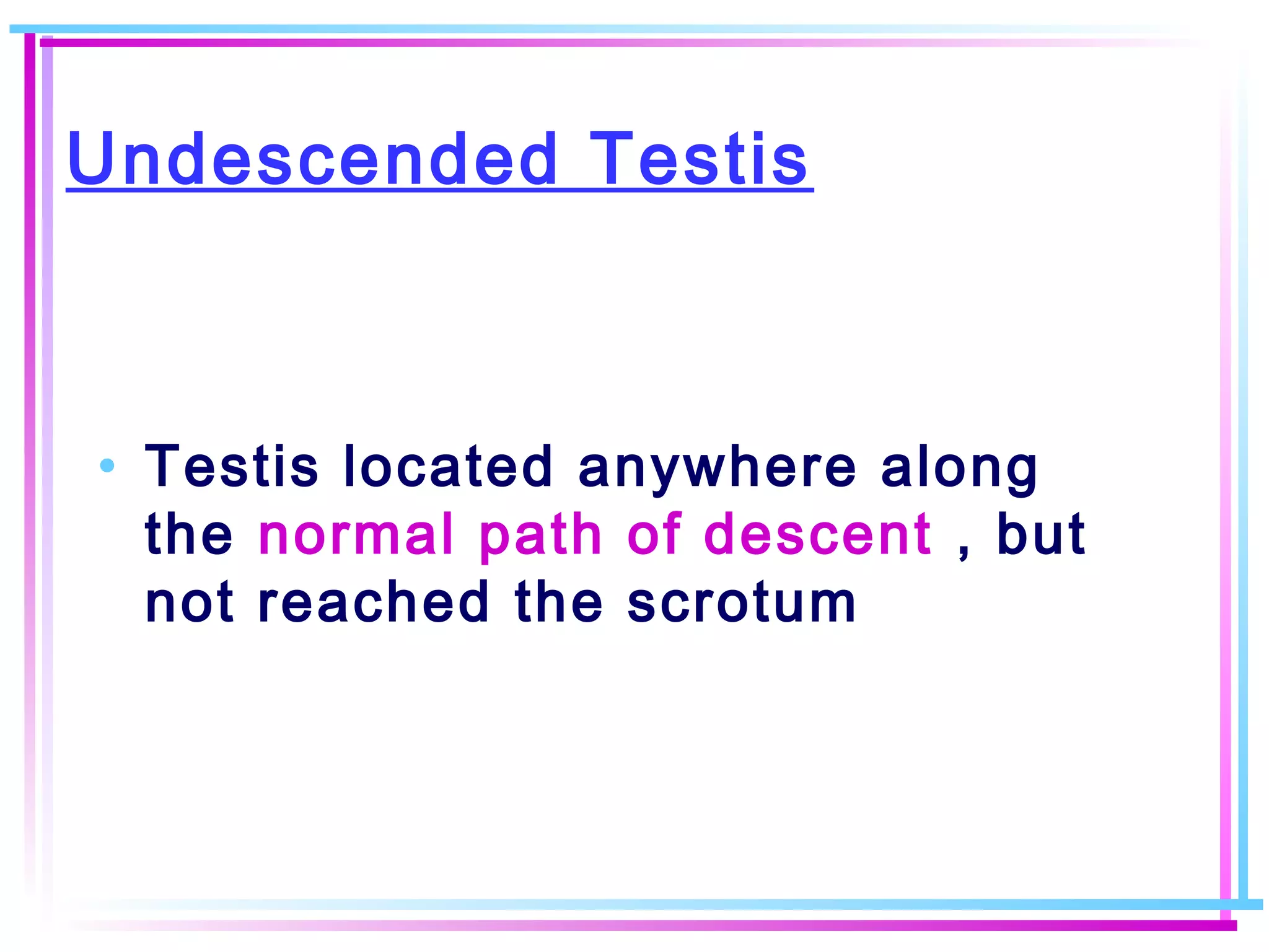 undescended testis | PPT