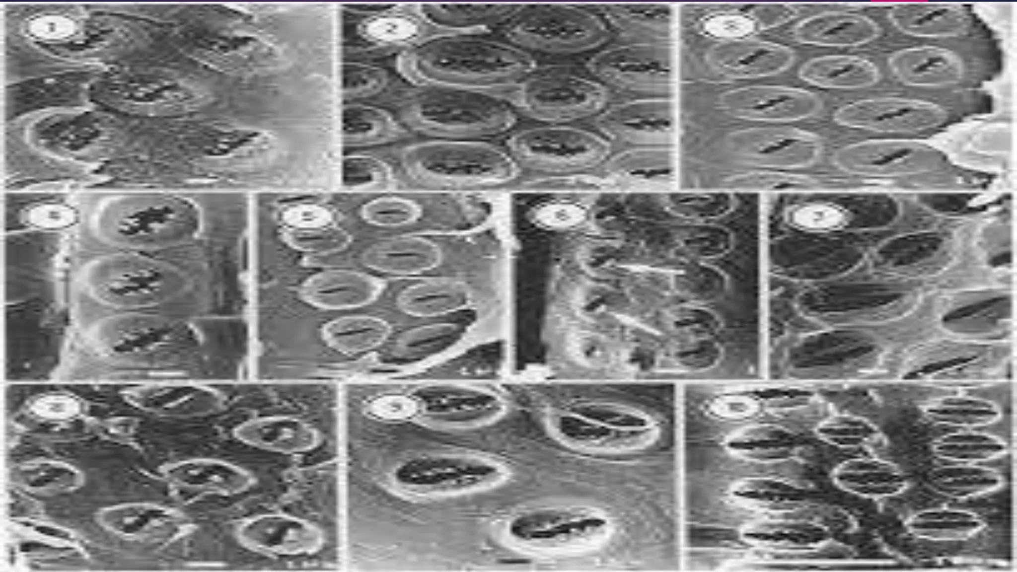 Pits and its types by Sohail | PPTX