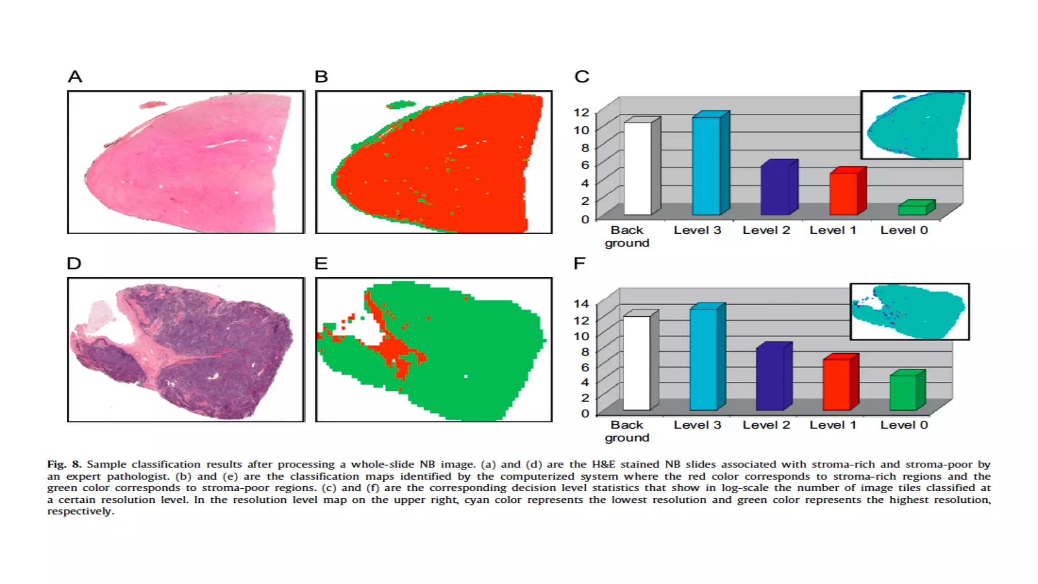 Digital Pathology: Precision Medicine, Deep Learning and Computer Aided ...