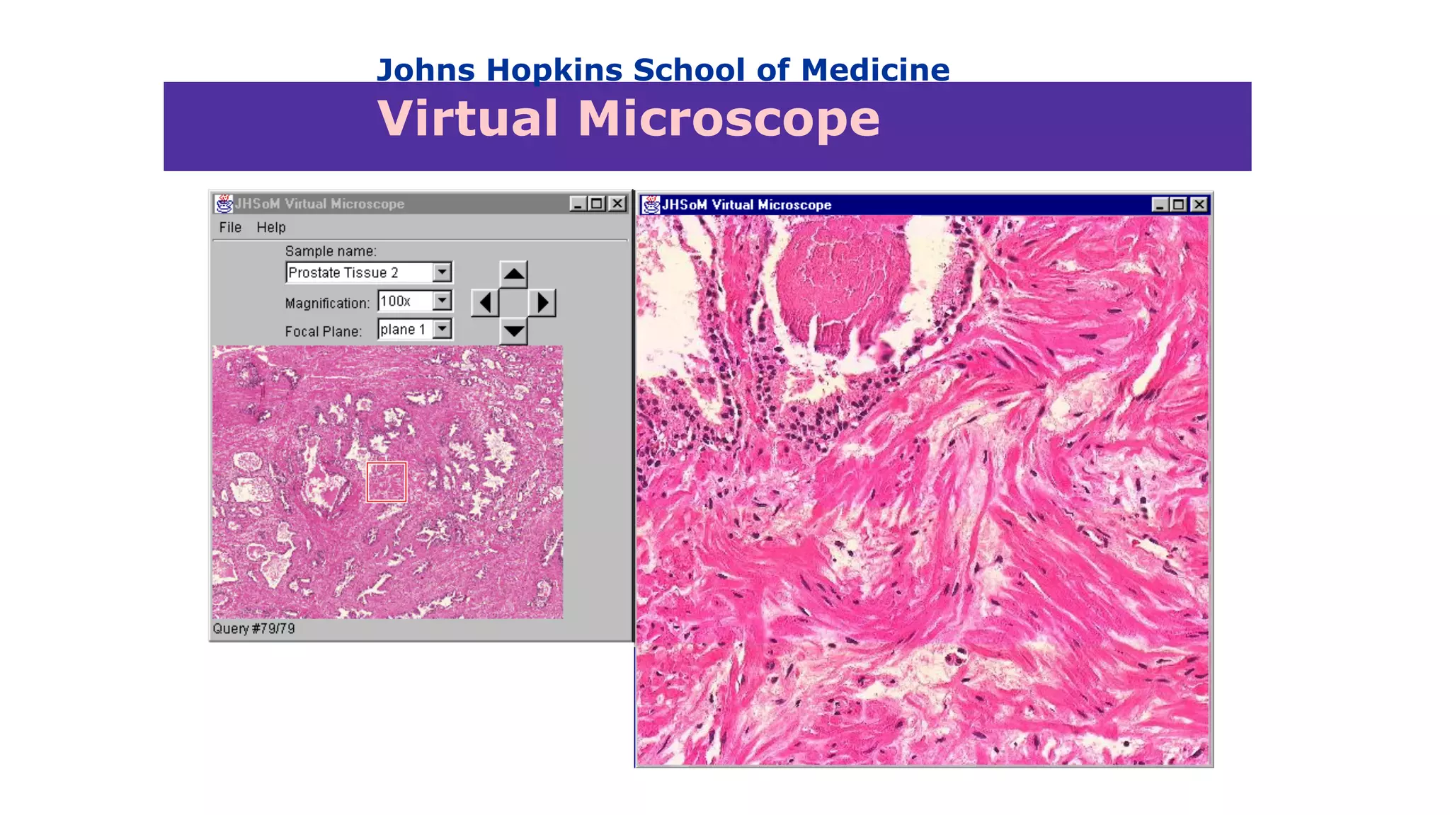 Digital Pathology: Precision Medicine, Deep Learning and Computer Aided ...