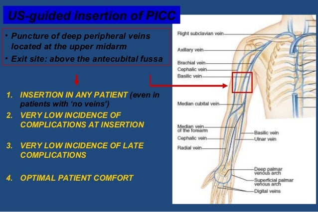 TARTING YOUR VENOUS ACCESS PROGRAM