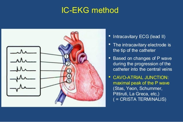 TARTING YOUR VENOUS ACCESS PROGRAM