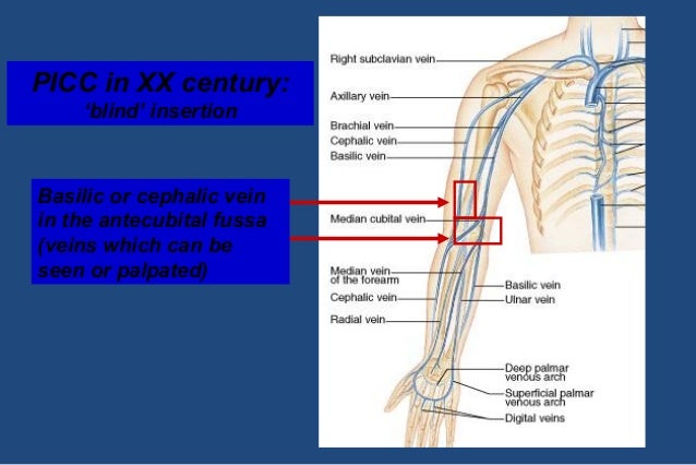 TARTING YOUR VENOUS ACCESS PROGRAM
