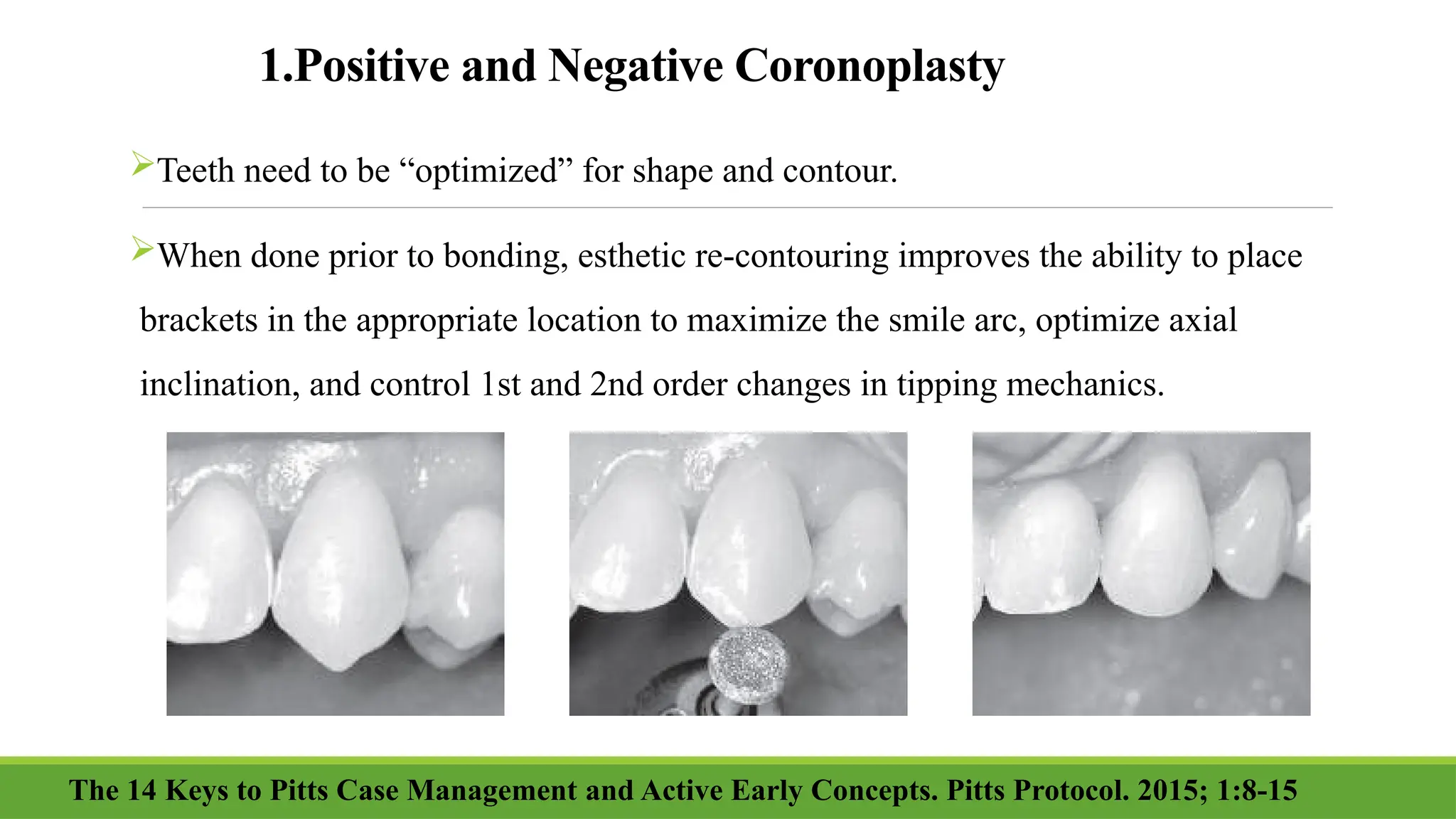 Pitts 21 The 14 Keys to Pitts Case Management.pptx
