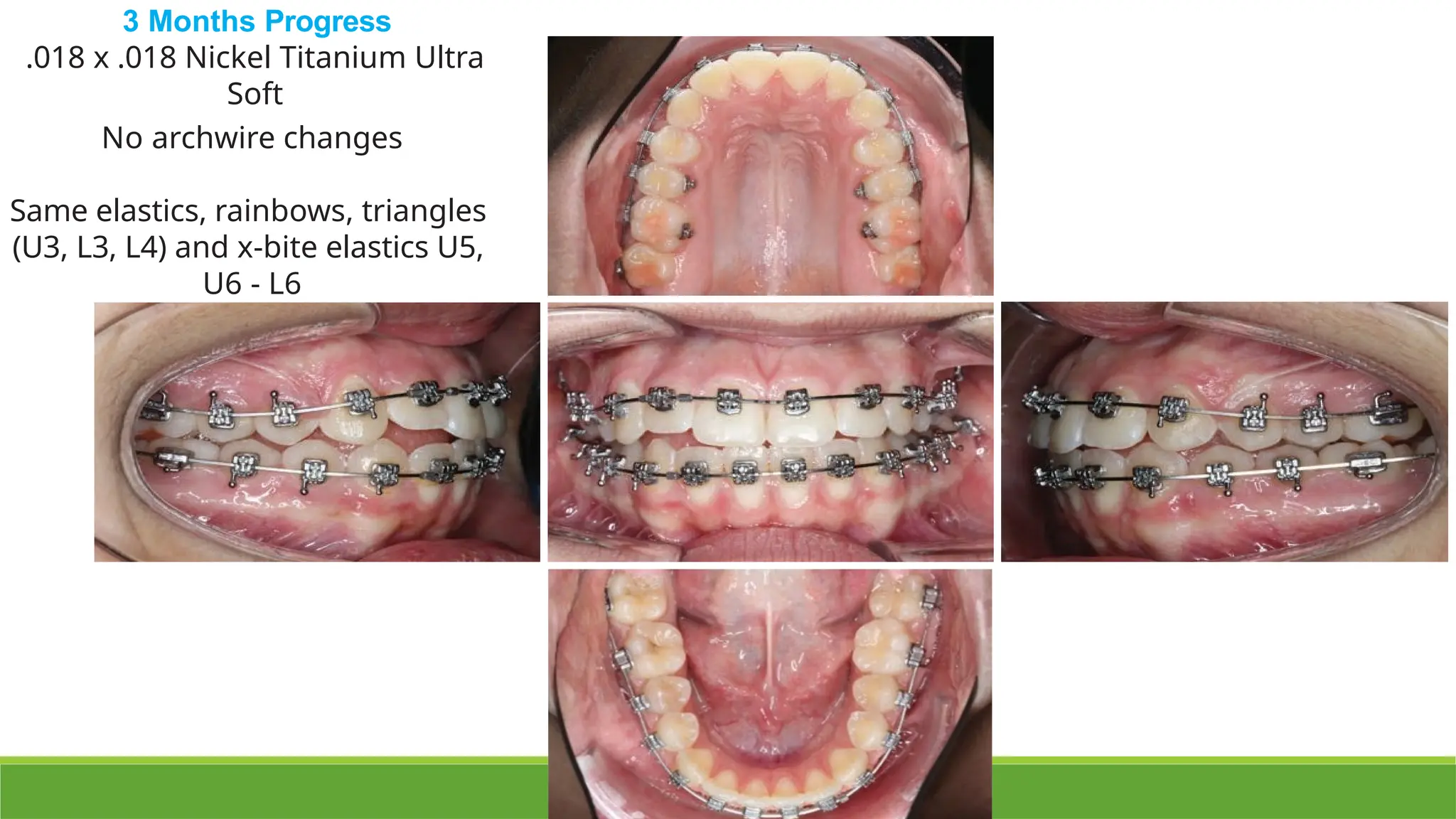 Pitts 21 The 14 Keys to Pitts Case Management.pptx