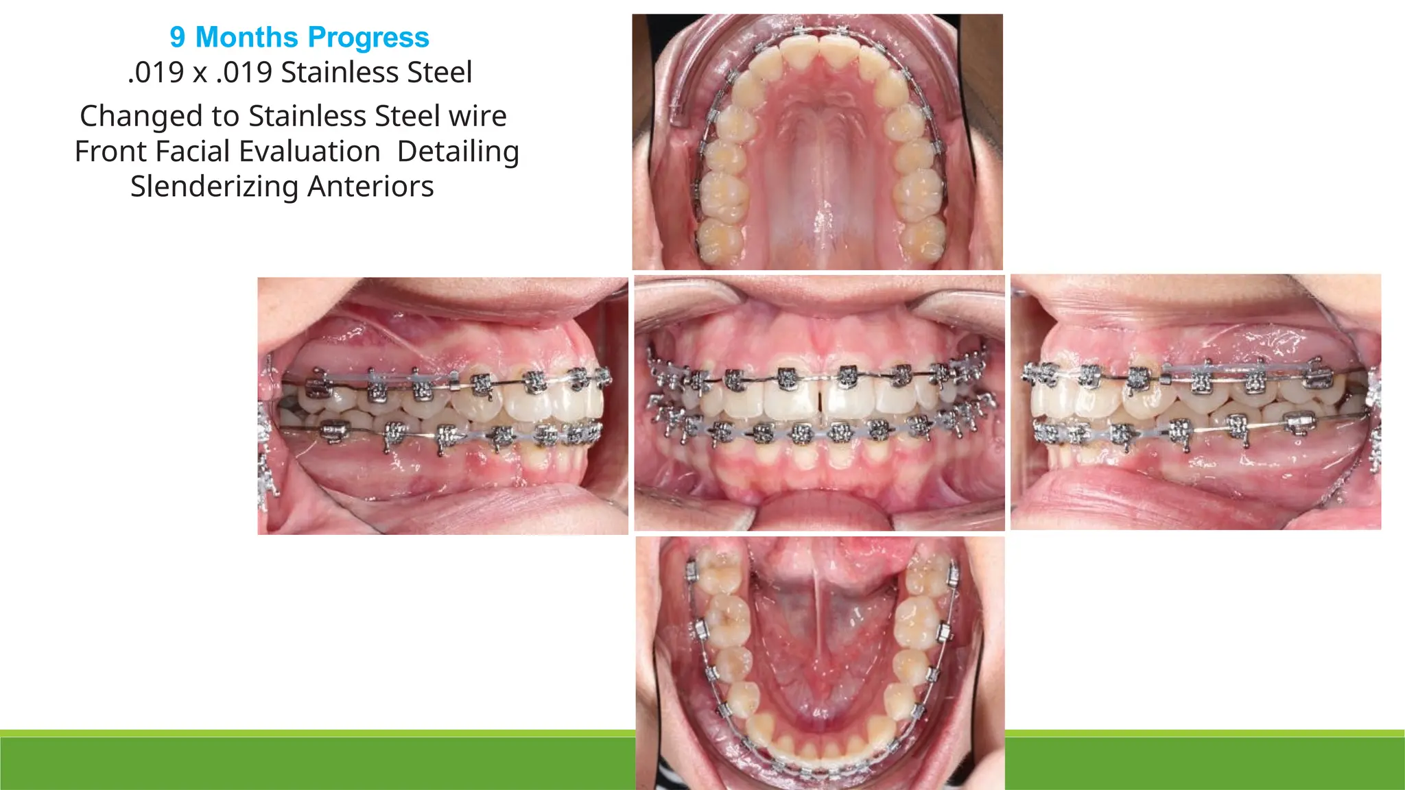 Pitts 21 The 14 Keys to Pitts Case Management.pptx
