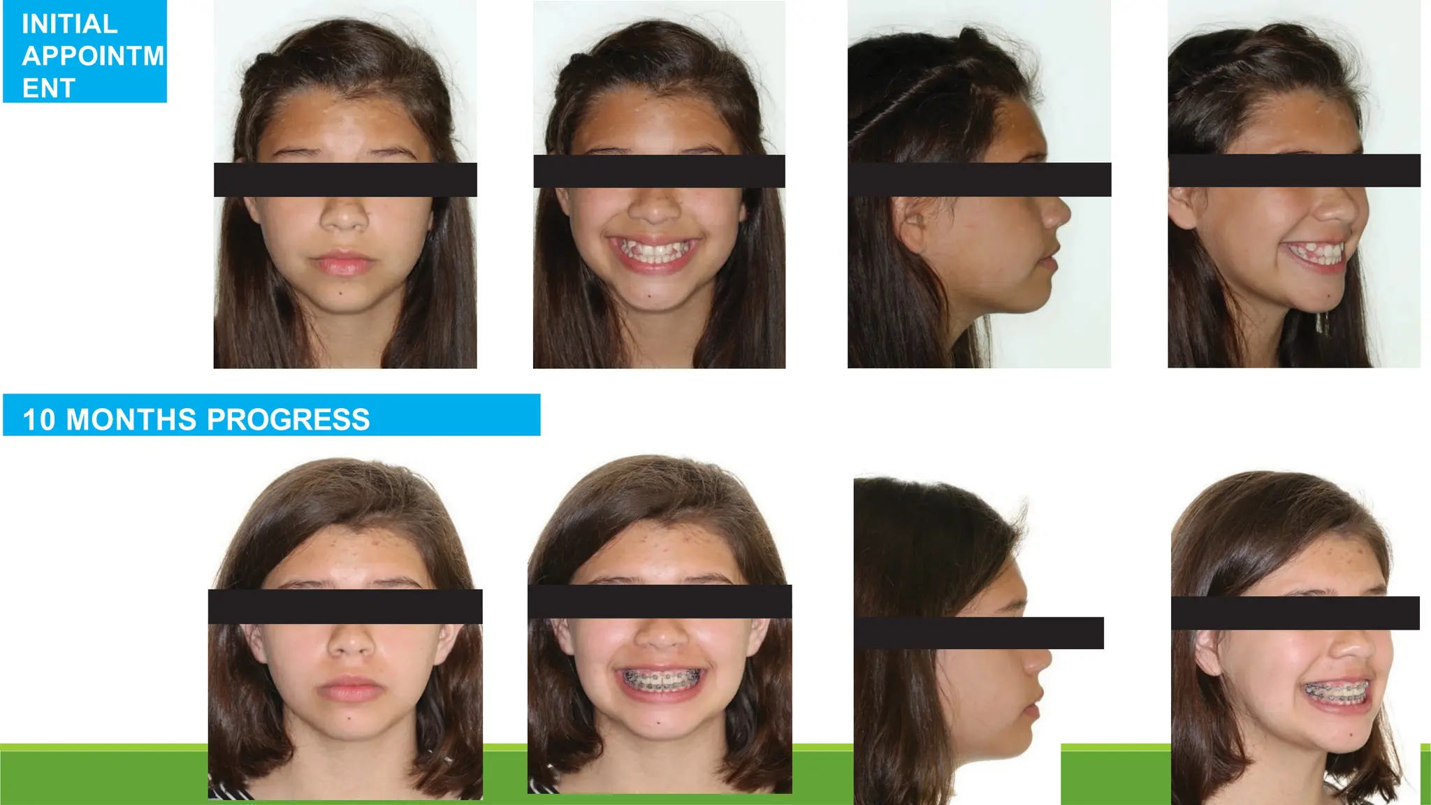 Pitts 21 The 14 Keys to Pitts Case Management.pptx