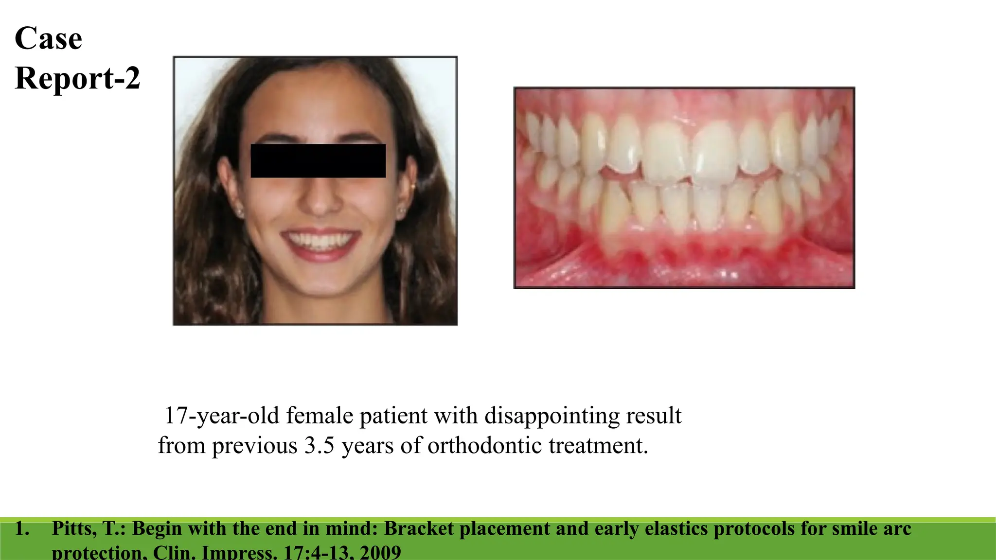 Pitts 21 The 14 Keys to Pitts Case Management.pptx