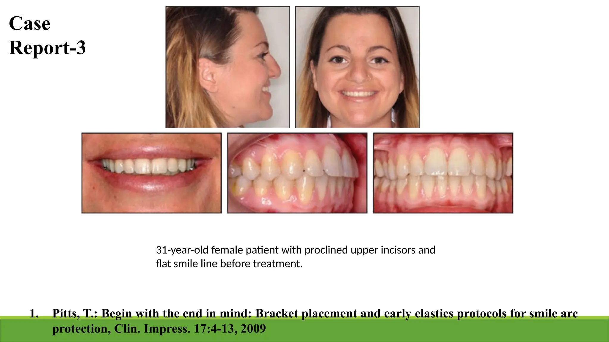 Pitts 21 The 14 Keys to Pitts Case Management.pptx